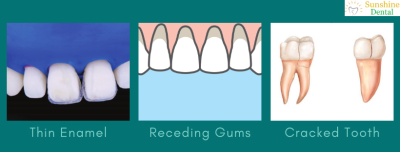 What Causes Teeth Sensitivity to Cold? How to Ease it? - Sunshine Dental